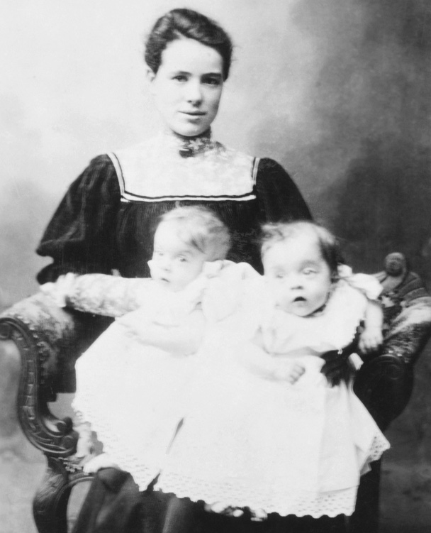 Violet and Daisy Hilton, San Antonio’s conjoined twins. Their uplifting ...